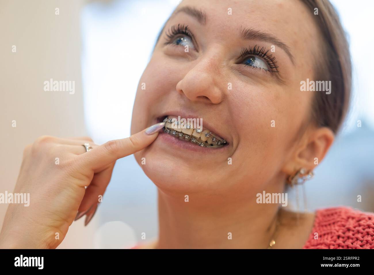 Portrait of a Caucasian woman with braces on her teeth. The girl ...