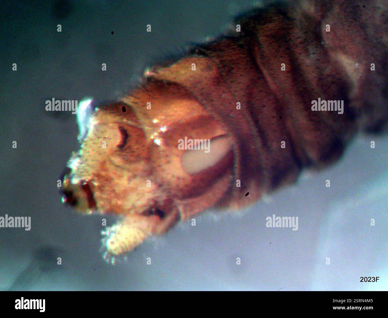 Posterior abdomen hi-res stock photography and images - Alamy