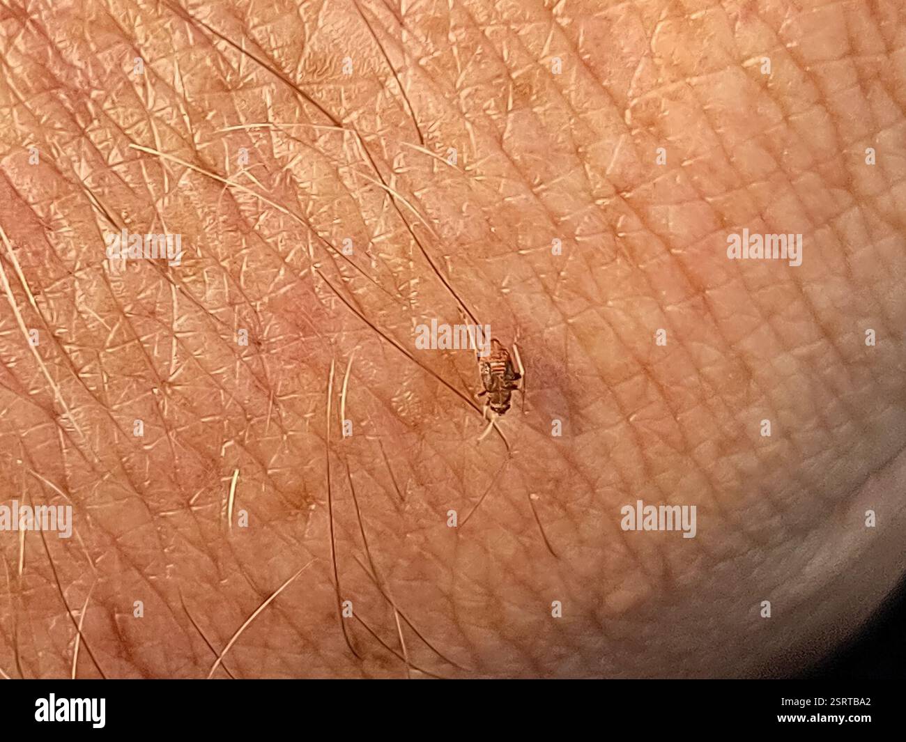 Psallus hi-res stock photography and images - Alamy