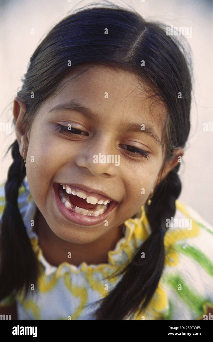 Girl showing broken teeth MR#202 Stock Photo - Alamy