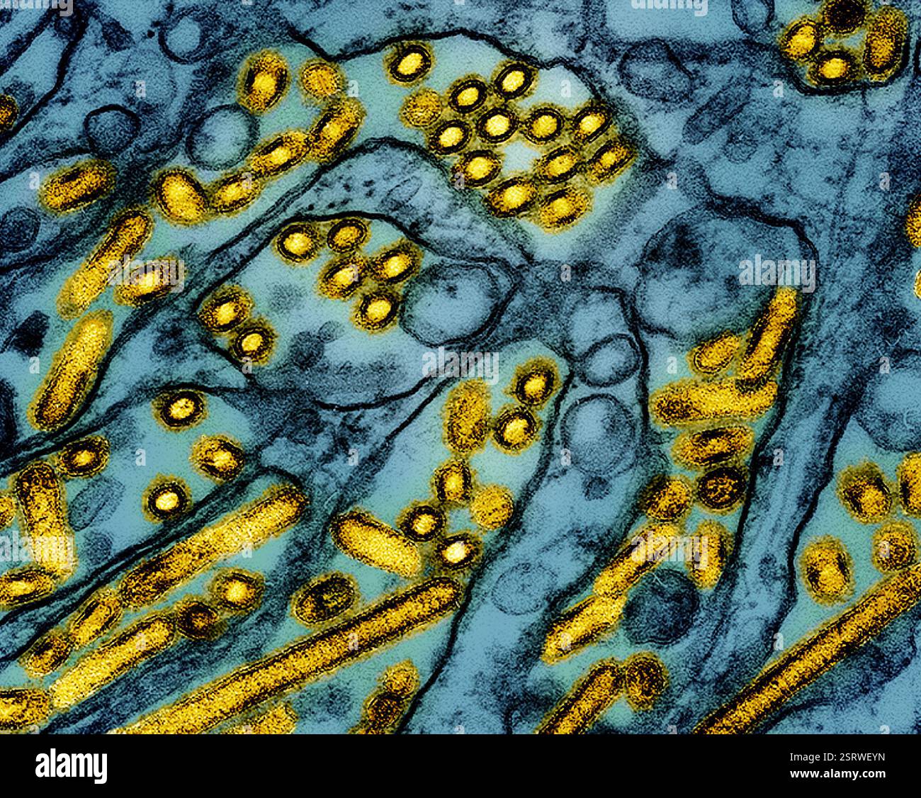 Avian Influenza A Virus (H5N1/Bird Flu) Colorized transmission electron ...