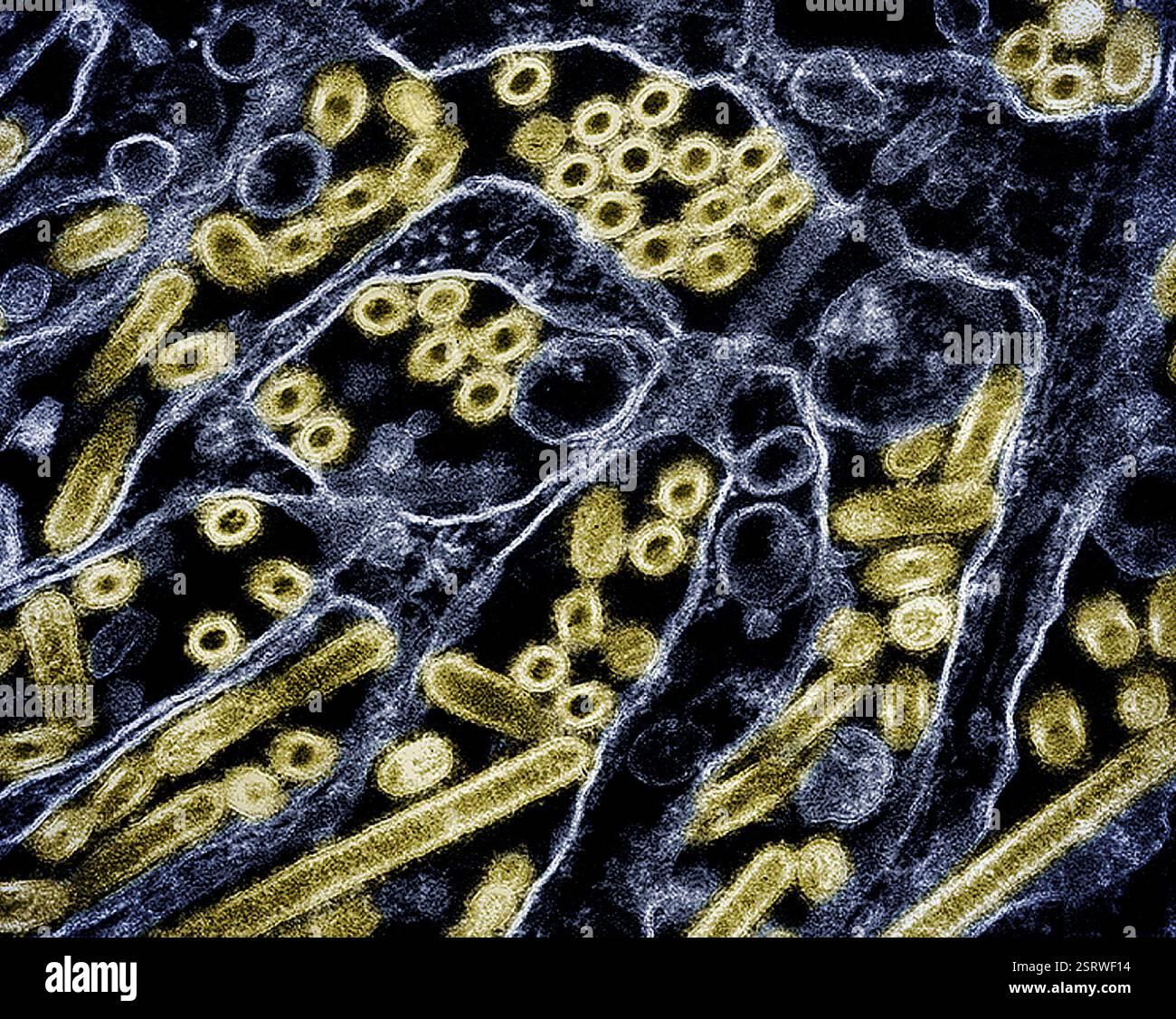 Avian Influenza A Virus (H5N1/Bird Flu) Colorized transmission electron ...