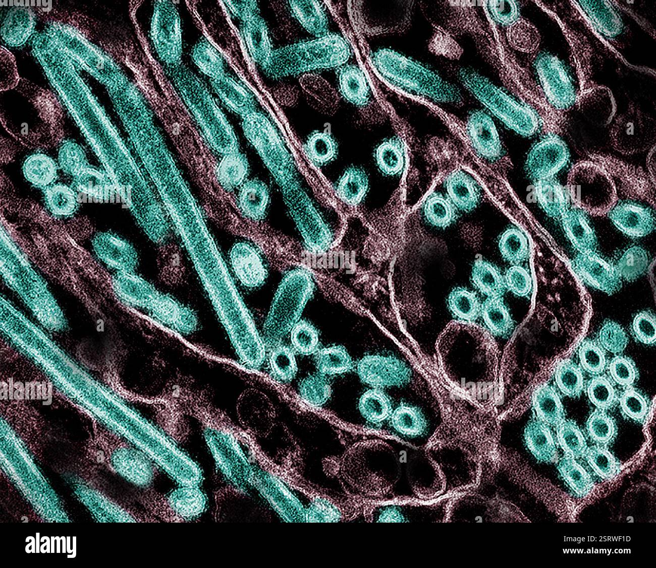 Avian Influenza A Virus (H5N1/Bird Flu) Colorized transmission electron ...