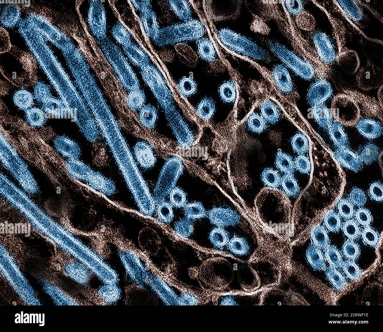 Avian Influenza A Virus (H5N1/Bird Flu) Colorized transmission electron ...