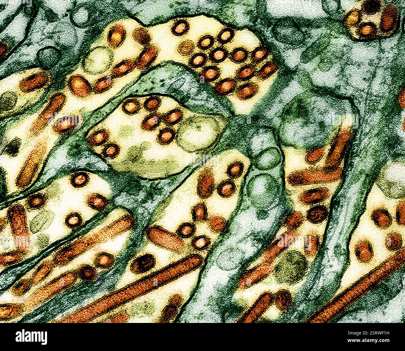 Avian Influenza A Virus (H5N1/Bird Flu) Colorized transmission electron ...