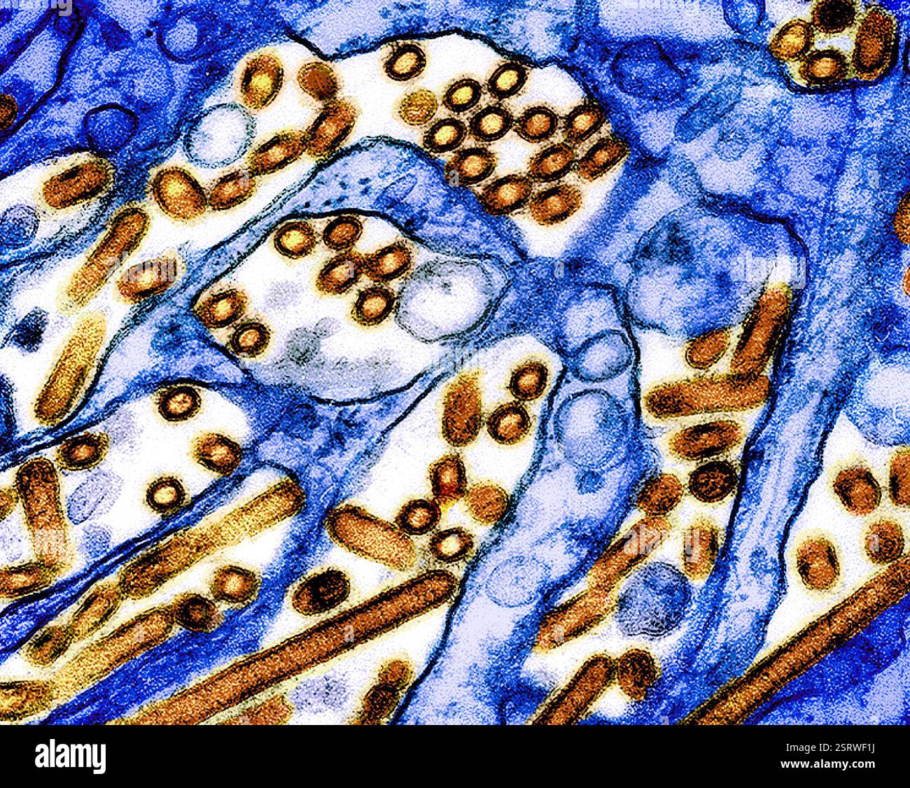 Avian Influenza A Virus (H5N1/Bird Flu) Colorized transmission electron ...