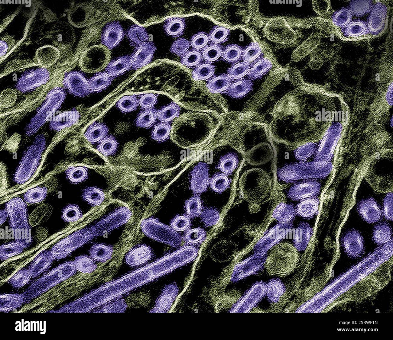 Avian Influenza A Virus (H5N1/Bird Flu) Colorized transmission electron ...