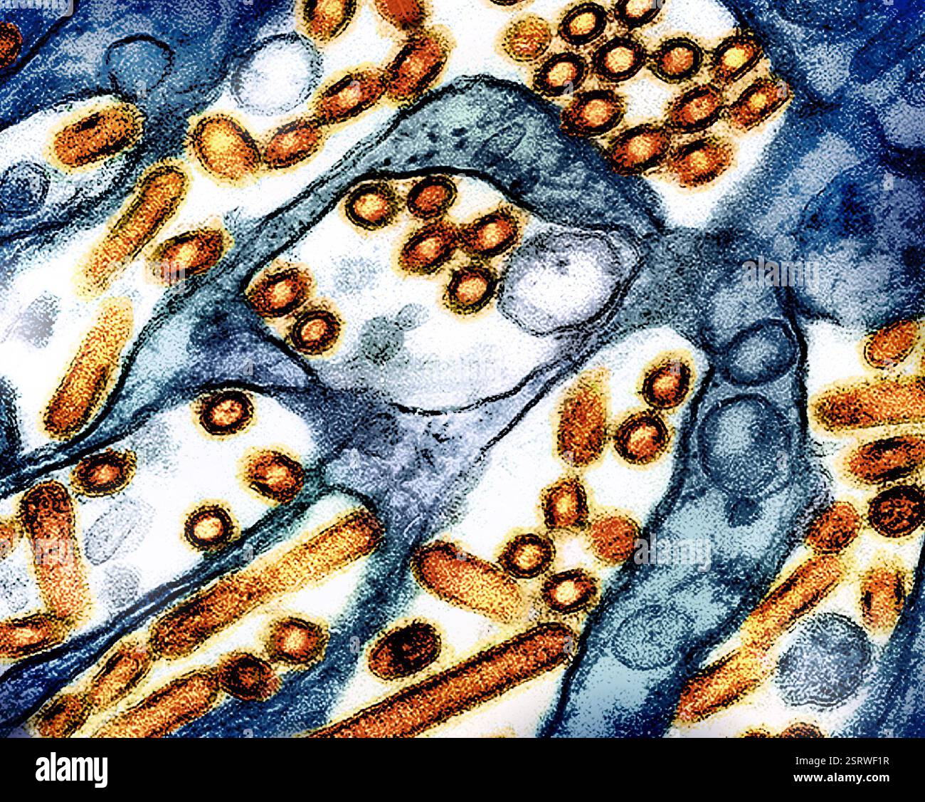 Avian Influenza A Virus (H5N1/Bird Flu) Colorized transmission electron ...
