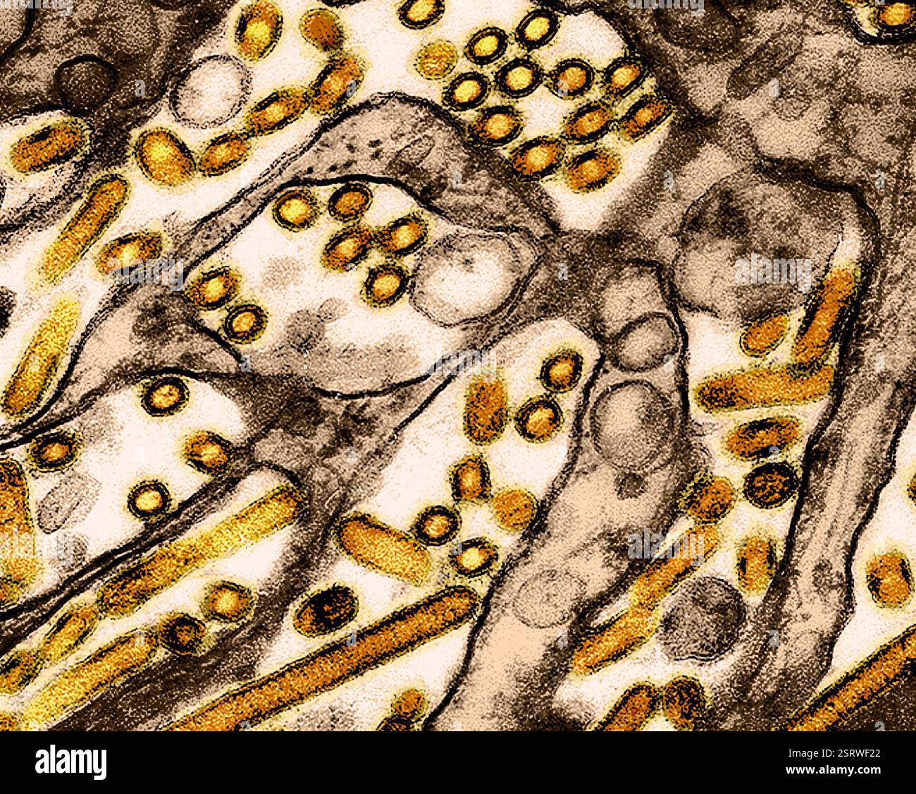 Avian Influenza A Virus (H5N1/Bird Flu) Colorized transmission electron ...