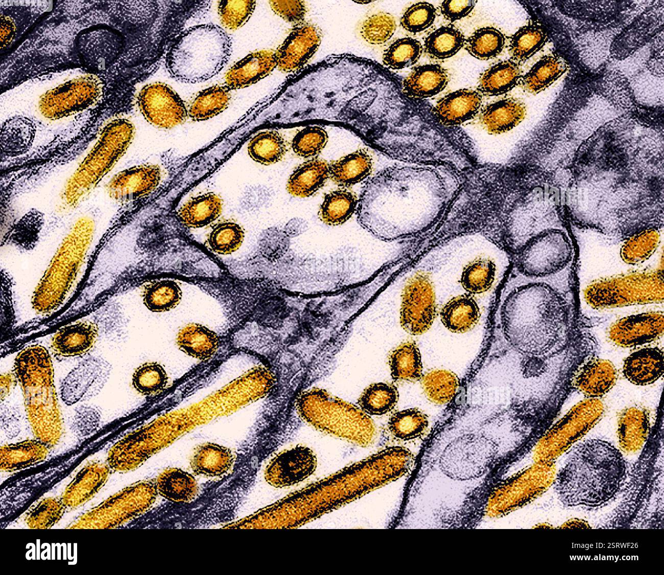 Avian Influenza A Virus (H5N1/Bird Flu) Colorized transmission electron ...