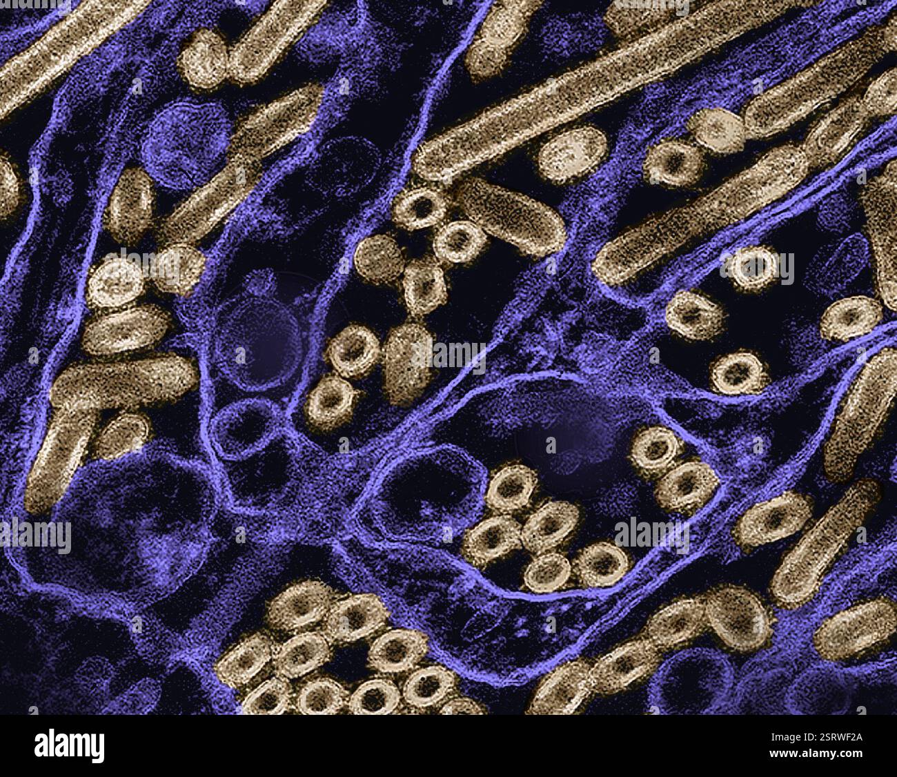 Avian Influenza A Virus (H5N1/Bird Flu) Colorized transmission electron ...