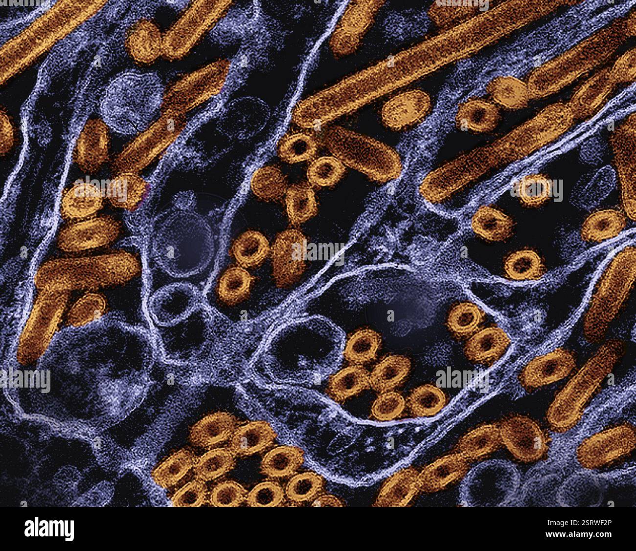 Avian Influenza A Virus (H5N1/Bird Flu) Colorized transmission electron ...