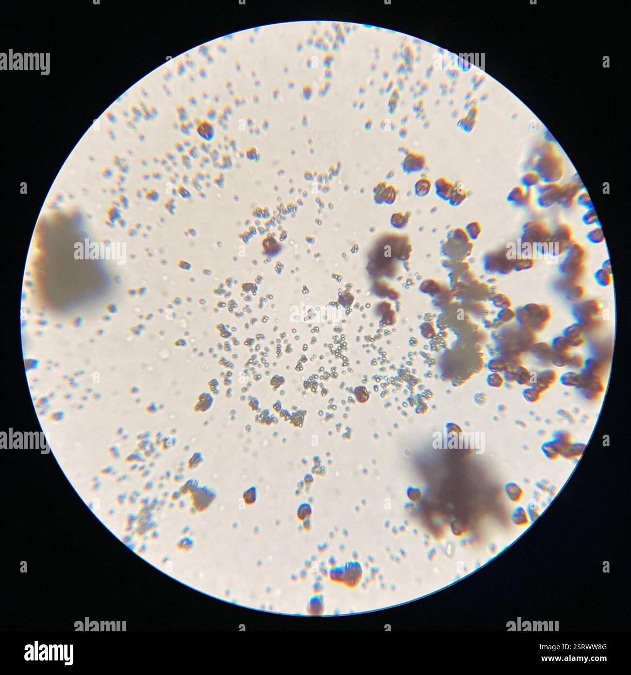 Dog Vomit Slime Mold (Fuligo septica), Protozoa, NW 98th Ave, Pembroke ...