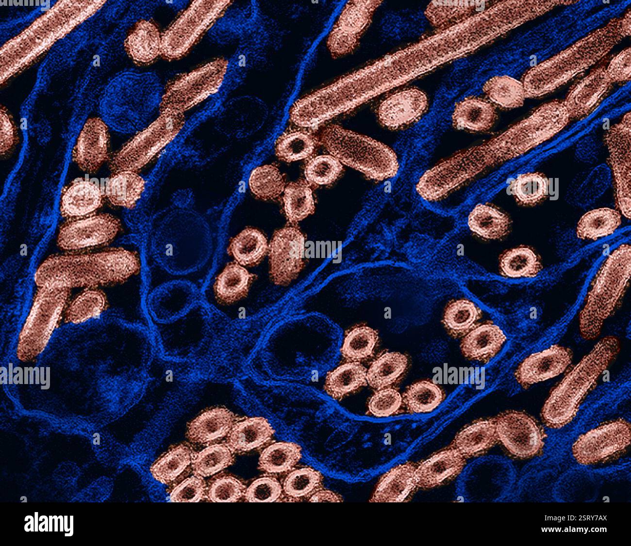 Atlanta, United States. 27 February, 2024. Colorized transmission ...