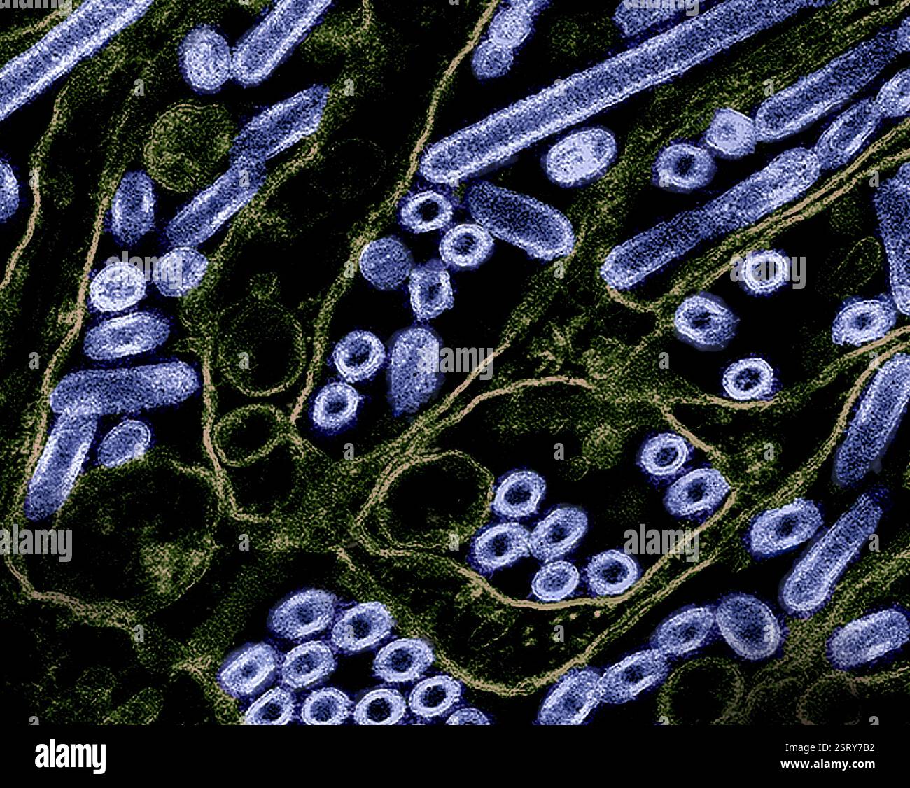 Atlanta, United States. 27 February, 2024. Colorized transmission ...