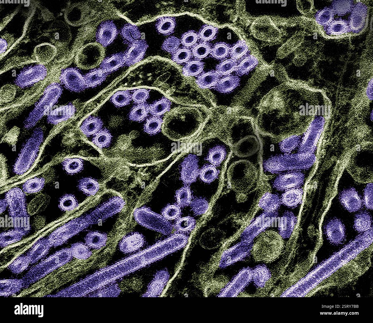 Atlanta, United States. 27 February, 2024. Colorized transmission ...