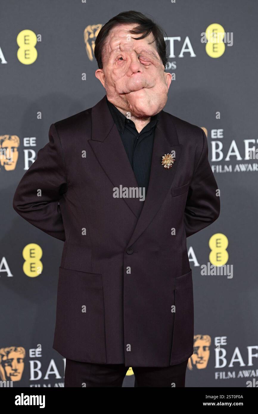 Actor adam pearson hi-res stock photography and images - Alamy