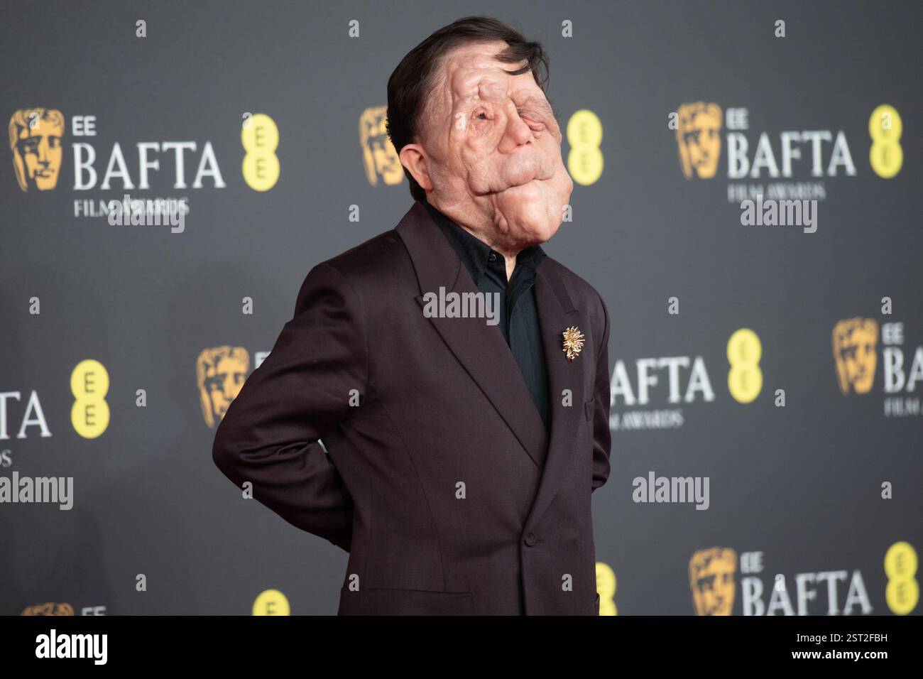London, UK. 16 Feb, 2025. Pictured: Adam Pearson attends The EE British Academy Film Awards 2025 ...