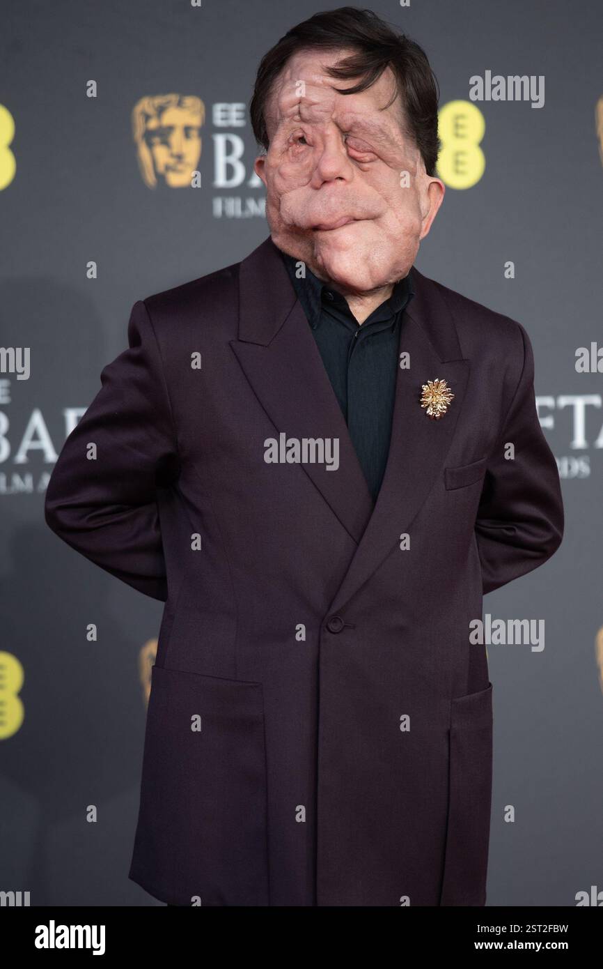 London, UK. 16 Feb, 2025. Pictured: Adam Pearson attends The EE British ...