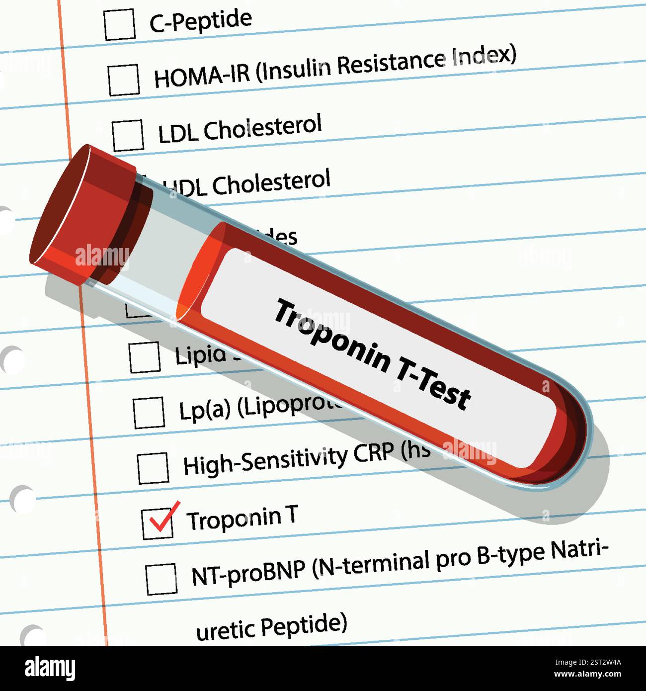 Illustration of a blood test checklist and tube Stock Vector Image ...
