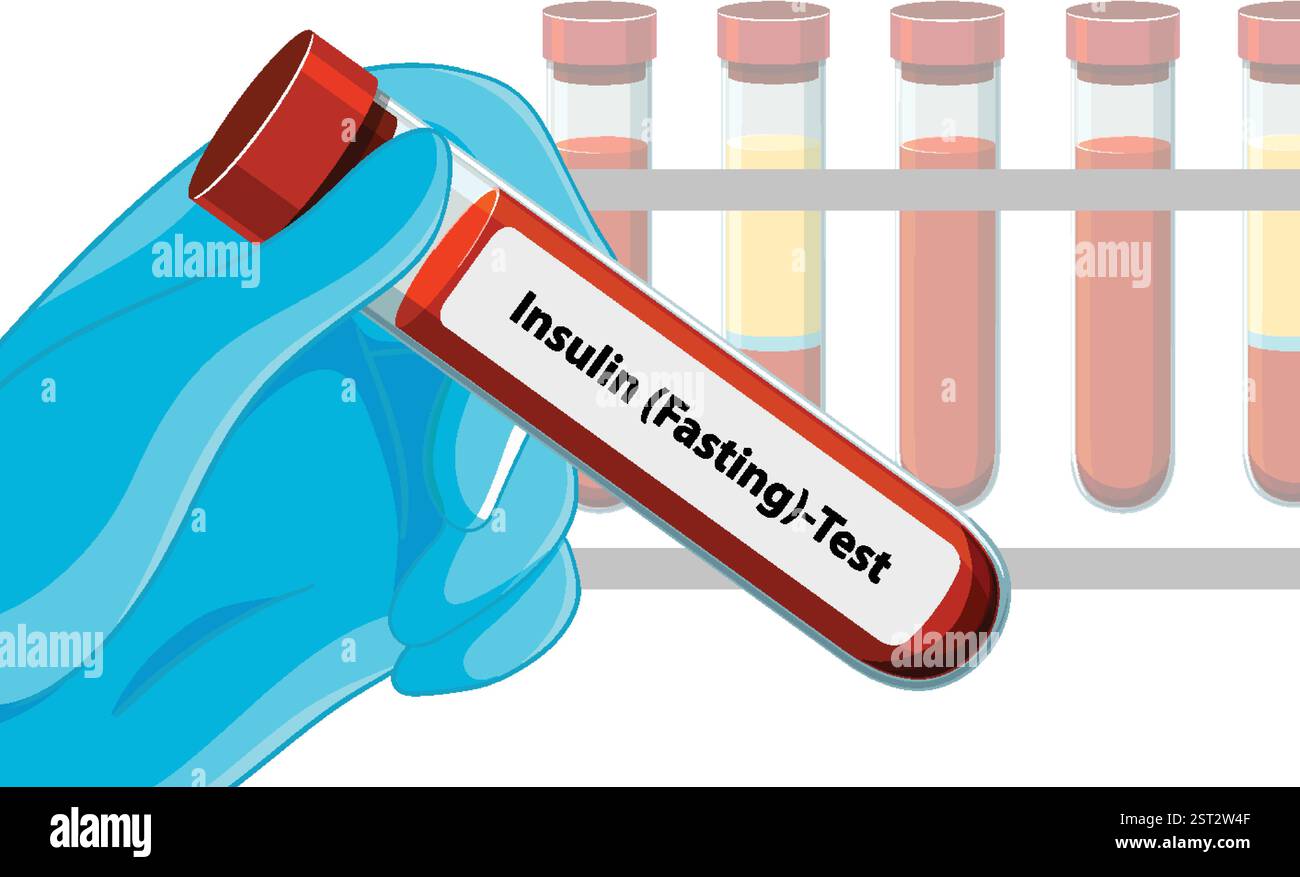How does insulin work vector vectors hi-res stock photography and ...