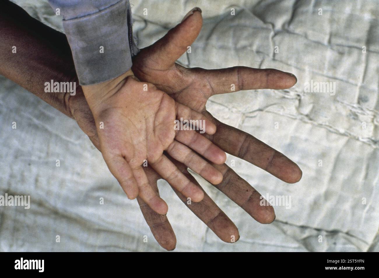 Hand with six fingers, india Stock Photo - Alamy