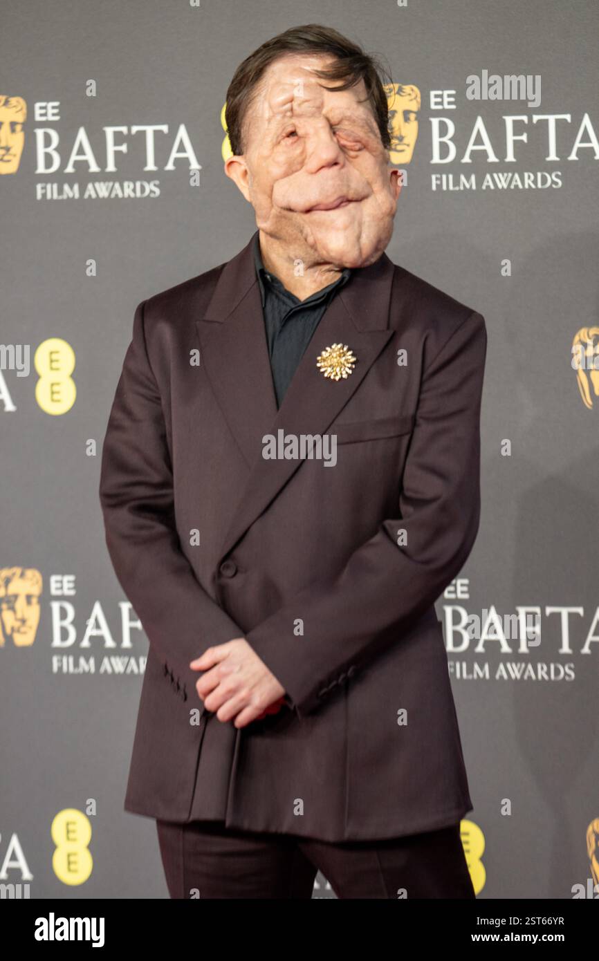 16/02//2025. London, UK Adam Pearson attends the EE BAFTA British ...