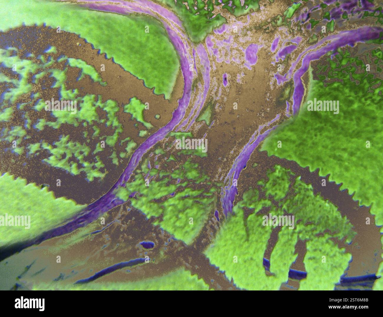 Neela, Pictorial art of two microphotographs of a vein and artery ...