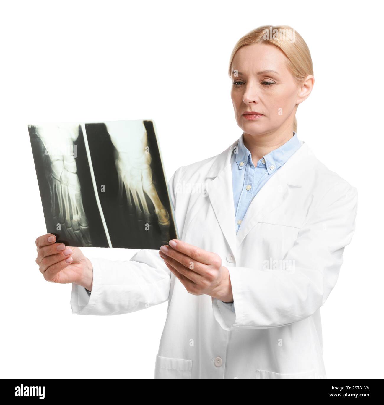 Doctor examining foot x-ray on white background Stock Photo - Alamy