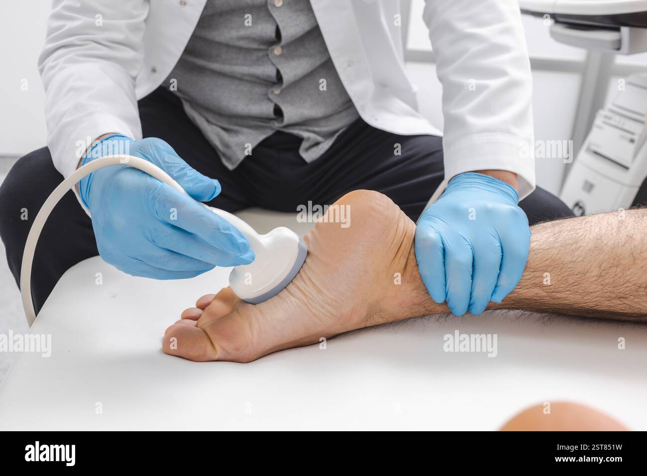 Close-up of injured foot during ultrasound scan with ultrasonic sensor ...