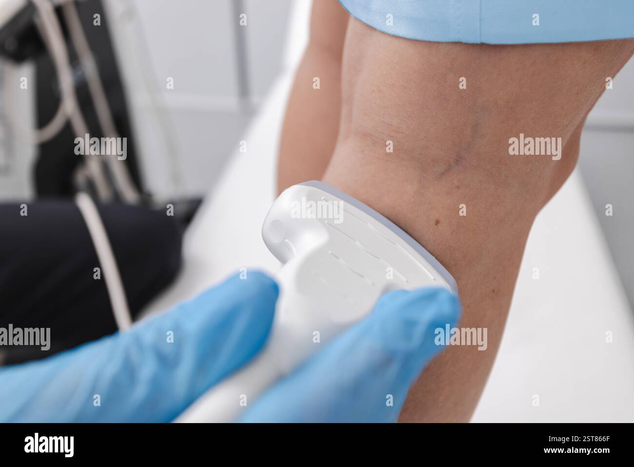 Ultrasound vascular diagnostics process of female patient's legs with ...