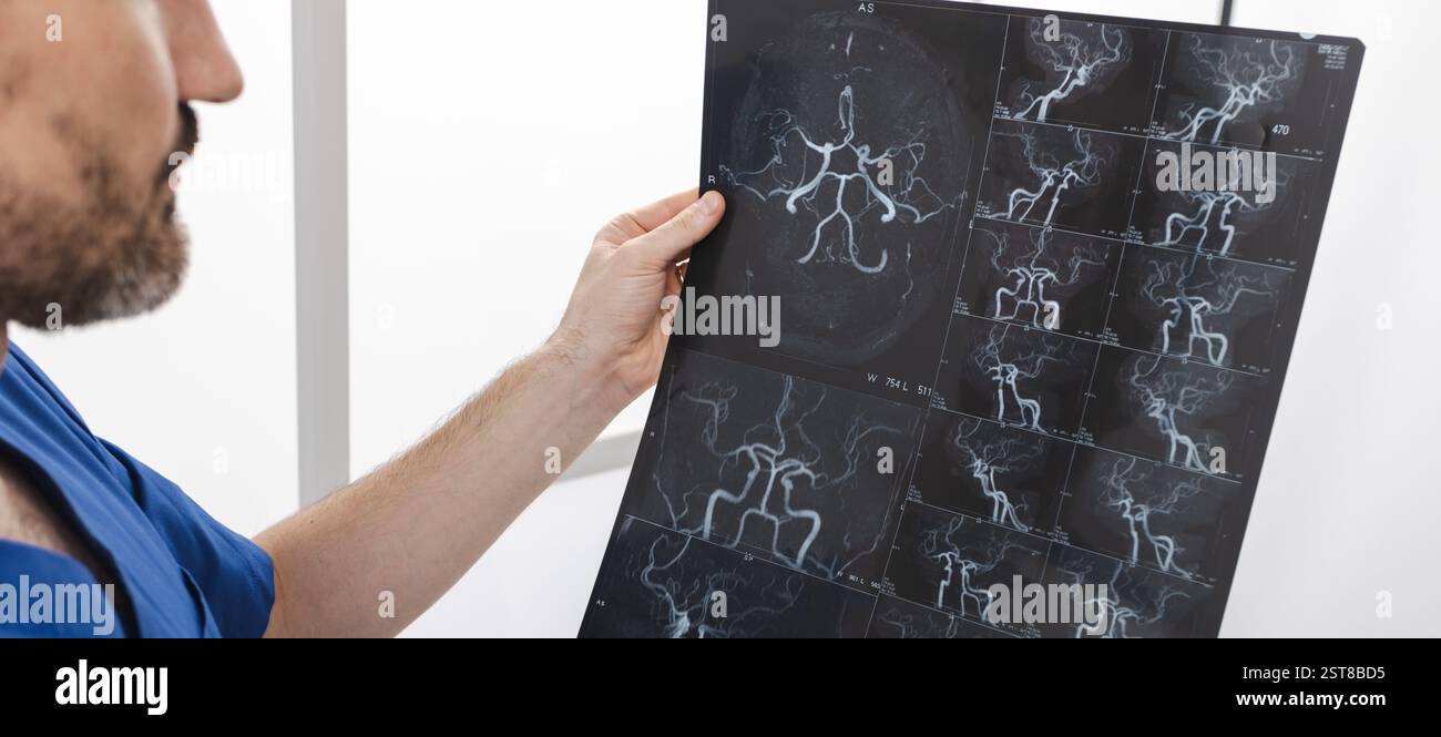 Doctor radiologist inspects MRI image of blood vessels of head ...