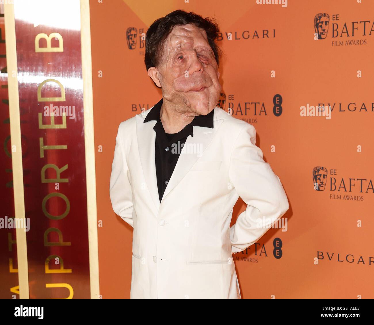 London, UK. 15th Feb, 2025. Adam Pearson attends the EE BAFTA Film ...