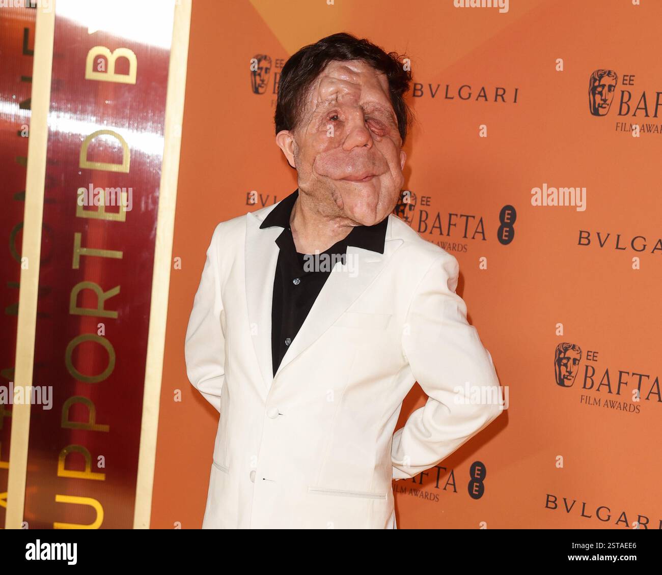 London, UK. 15th Feb, 2025. Adam Pearson attends the EE BAFTA Film ...