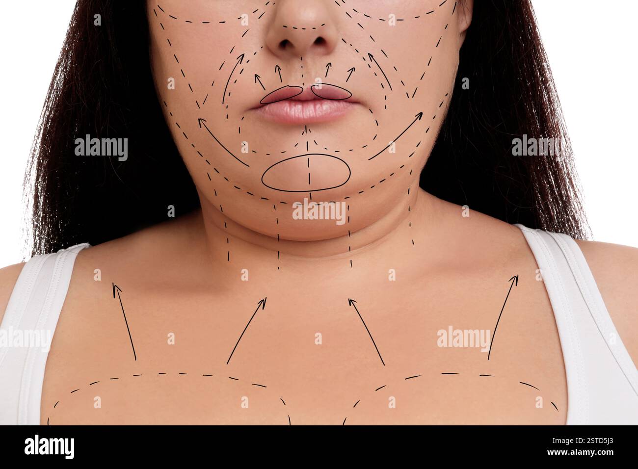 Plastic surgery. Woman with double chin on white background, closeup ...
