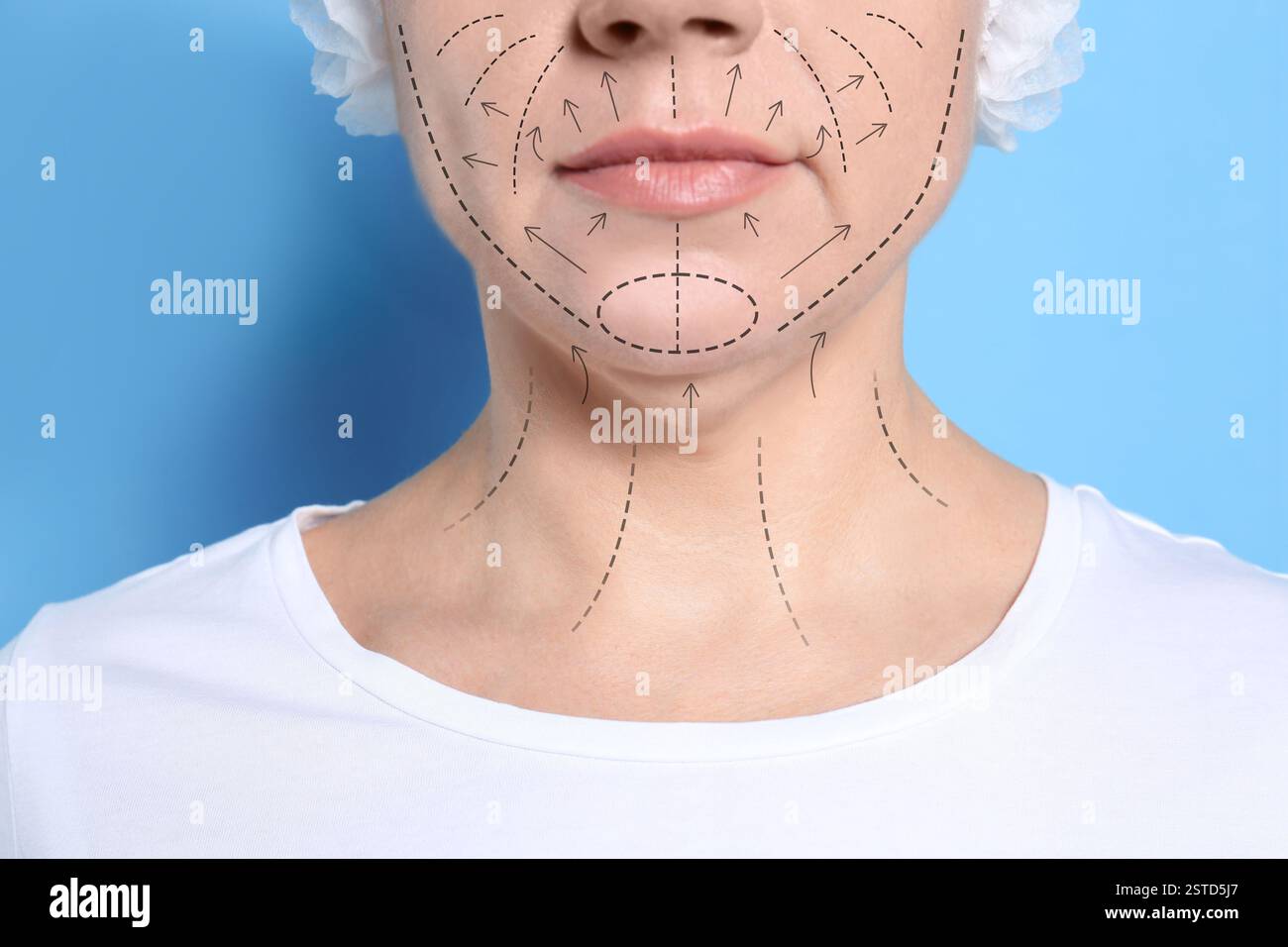 Plastic surgery. Mature woman with double chin on light blue background ...