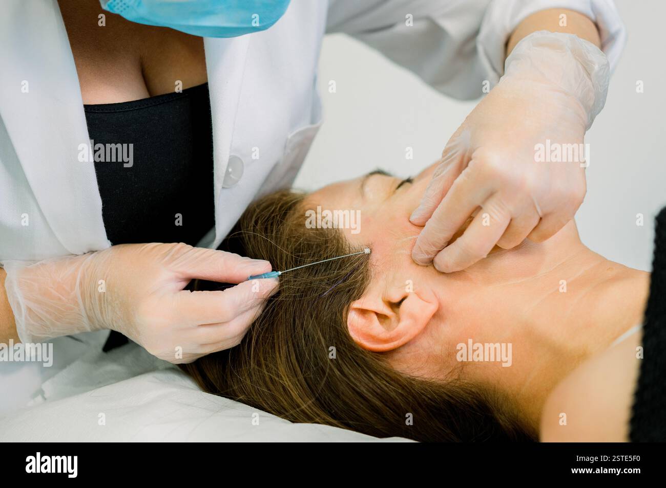 A medical professional in sterile gloves applies a facial aesthetic treatment using hyaluronic ...