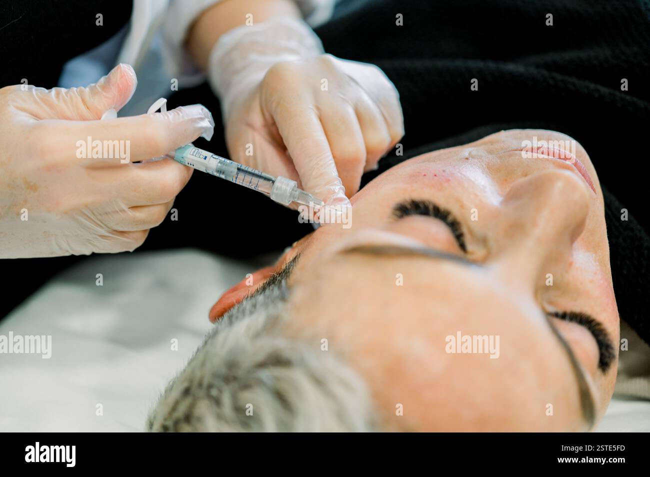Close-up of a patient receiving a cosmetic dermal filler injection ...