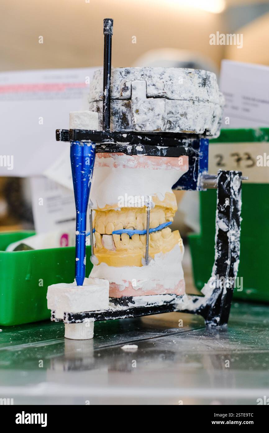 Dental mold of teeth in articulator covered in plaster at a dental lab ...