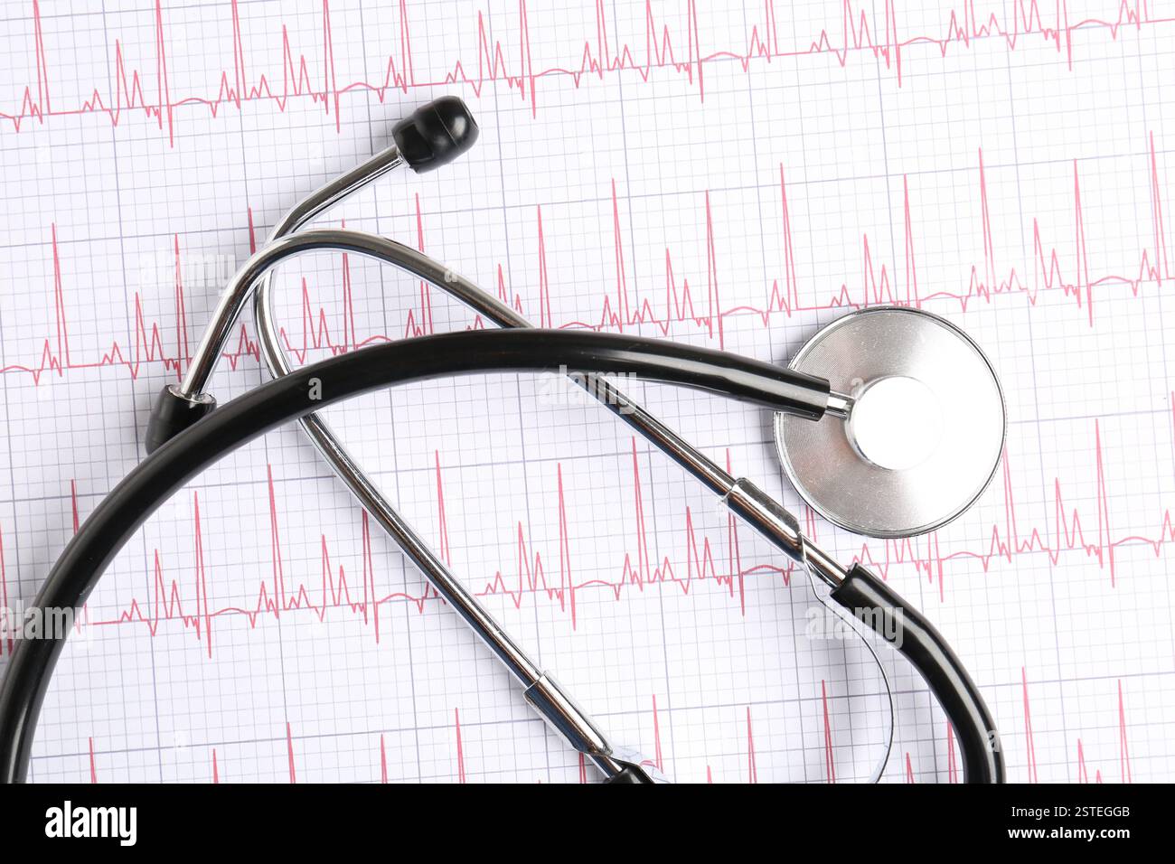 Cardiology. Stethoscope on paper with cardiogram, top view Stock Photo ...