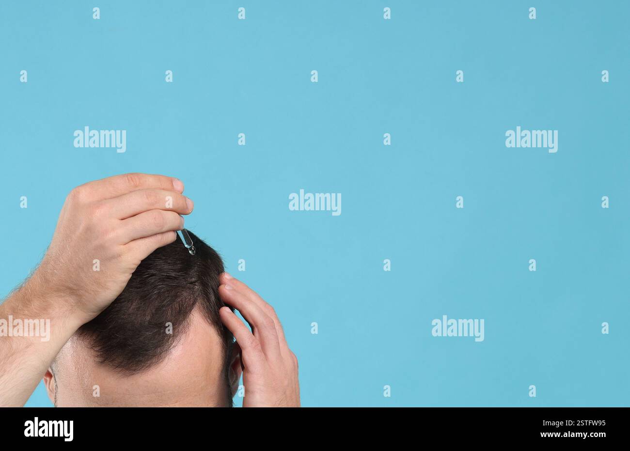 Baldness treatment. Man applying serum onto hair on light blue ...