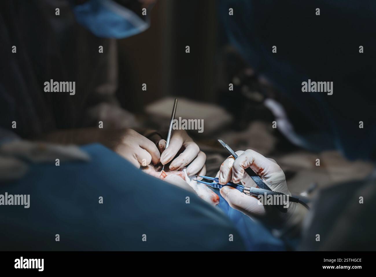 Surgeons in action performing surgery with focused lighting on their ...