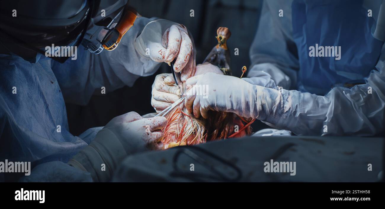 Medical team performing surgery with intense focus and precision in an ...