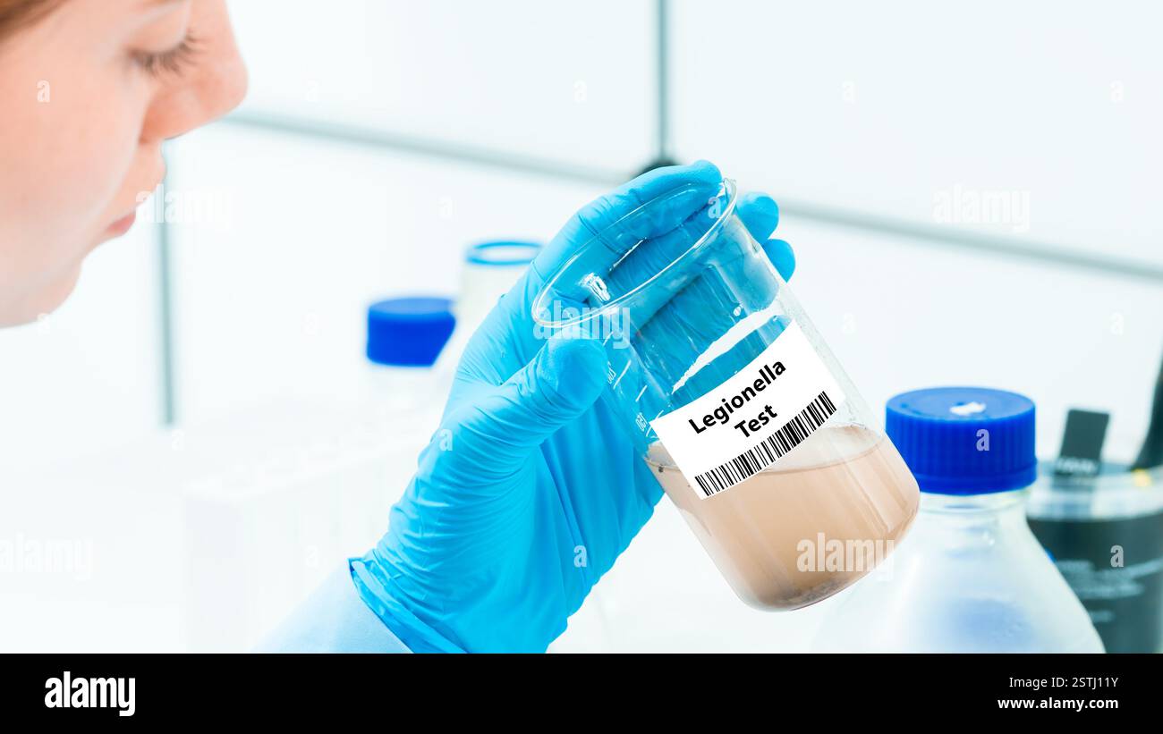 Legionella Test Measures the presence of Legionella bacteria in water ...