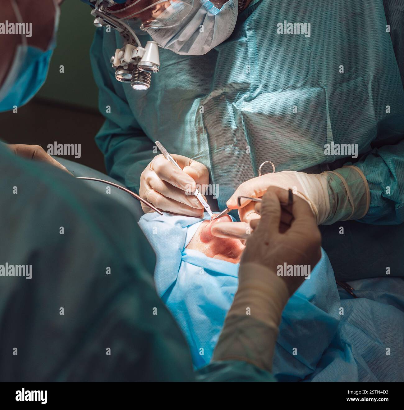 Cosmetic surgery on nose. The surgeon cuts the flesh Stock Photo - Alamy