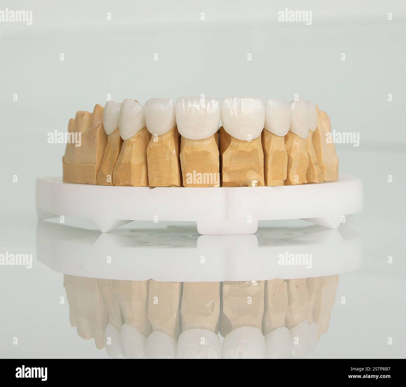 Zircon teeth veneers from the dental technician in the lower jaw Stock ...
