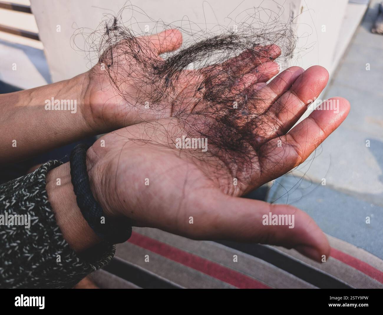 Handful of fallen hairs after combing in men, showcasing rising ...
