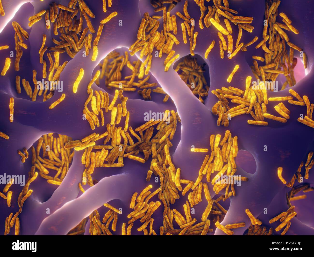 Tuberculosis (TB) is a pulmonary infectious disease,aka consumption, a.k.a the "white death" and ...