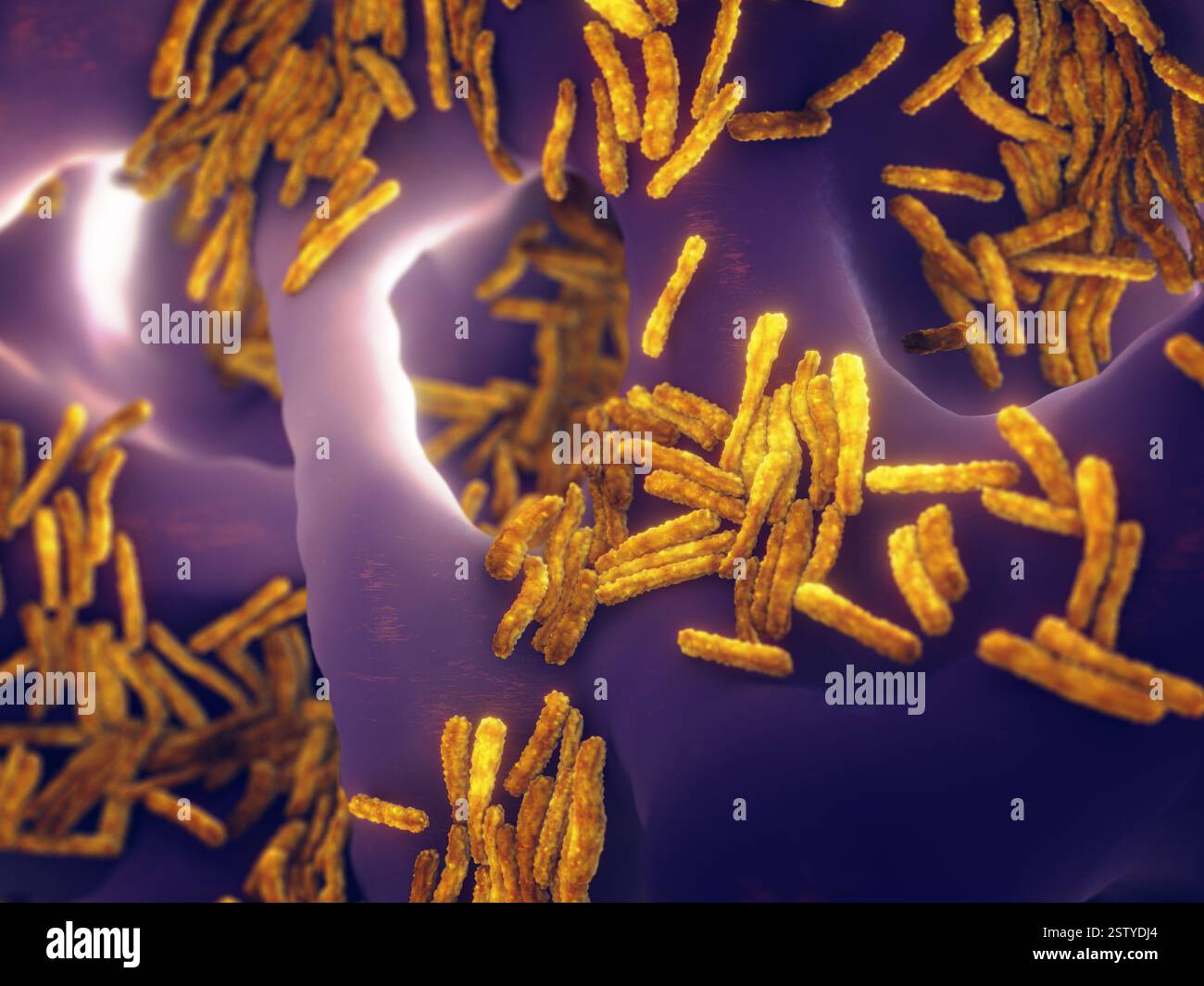 Tuberculosis (TB) is a pulmonary infectious disease,aka consumption, a.k.a the "white death" and ...