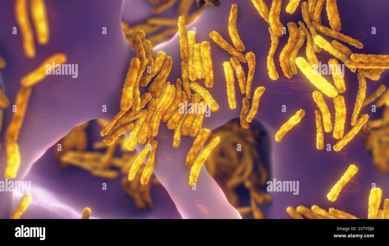 Tuberculosis (TB) is a pulmonary infectious disease,aka consumption, a.k.a the "white death" and ...